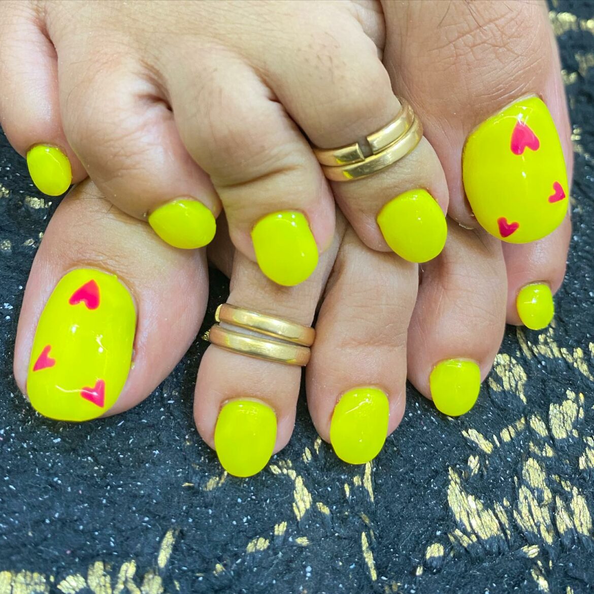 35 Neon Pedicure Ideas to Make a Bold Statement in 2024